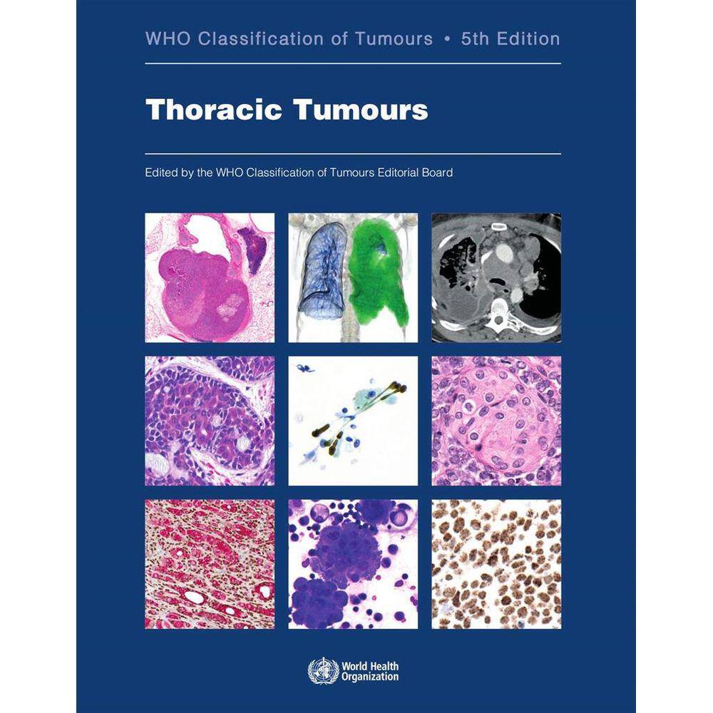 Digestive system tumours who classification of tumours medicine by who ... Digestive system tumours who classification of tumours medicine by who ...