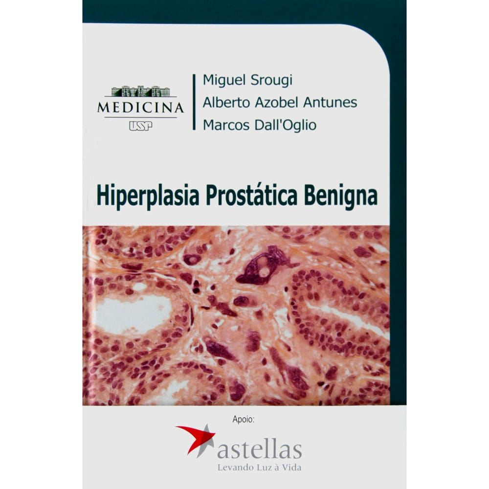 Hiperplasia muscular | Casas Bahia Hiperplasia muscular | Casas Bahia