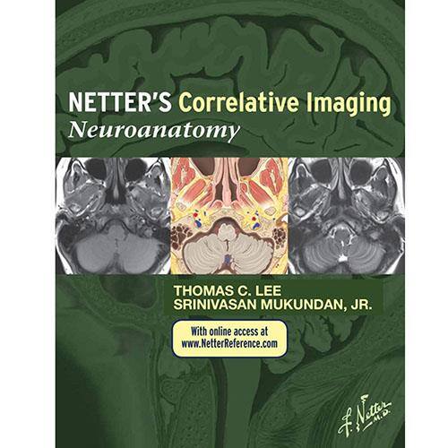 Neuroanatomia netter | Casas Bahia